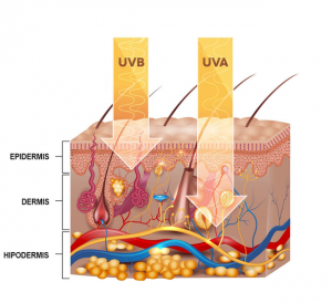 PUVA Therapy For Skin Diseases: Treatment Features | Heliotherapy ...