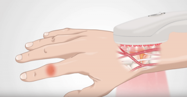 LED Light Therapy & LightStim For Pain: Facts You Can’t Ignore ...