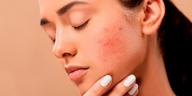 5 Highly Effective Methods For Getting Rid Of Textured Skin ...